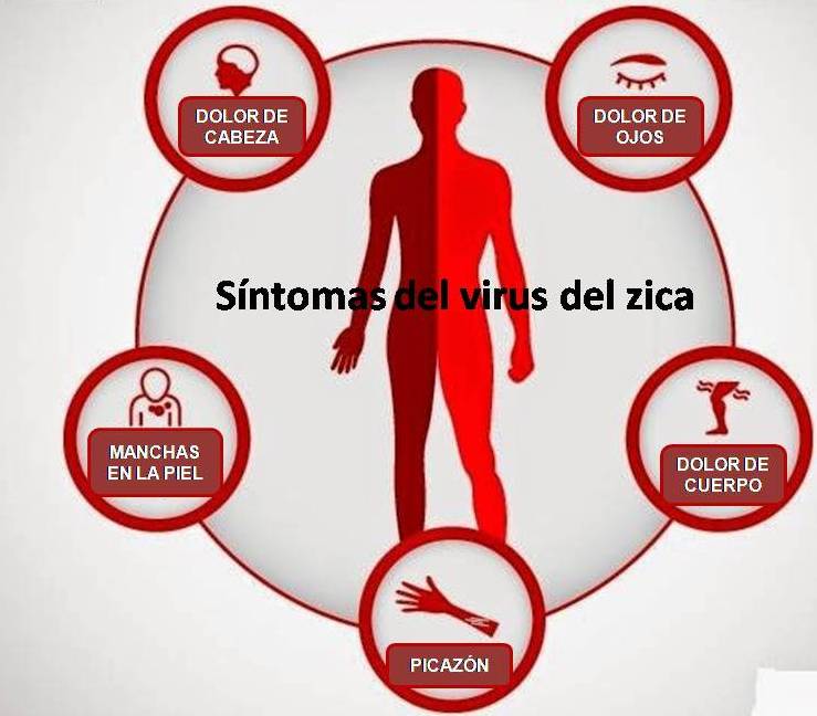 Tamaulipas en alerta por caso de zica - Grupo Milenio