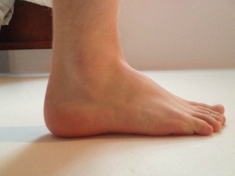 ¿Talones descarapelados? Te decimos por qué - Grupo Milenio