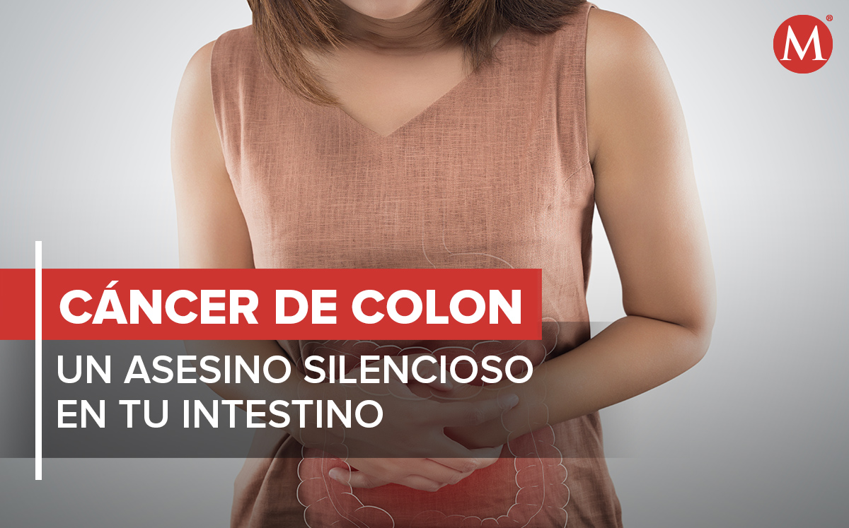 Cáncer de Colón: qué es, síntomas y etapas - Grupo Milenio