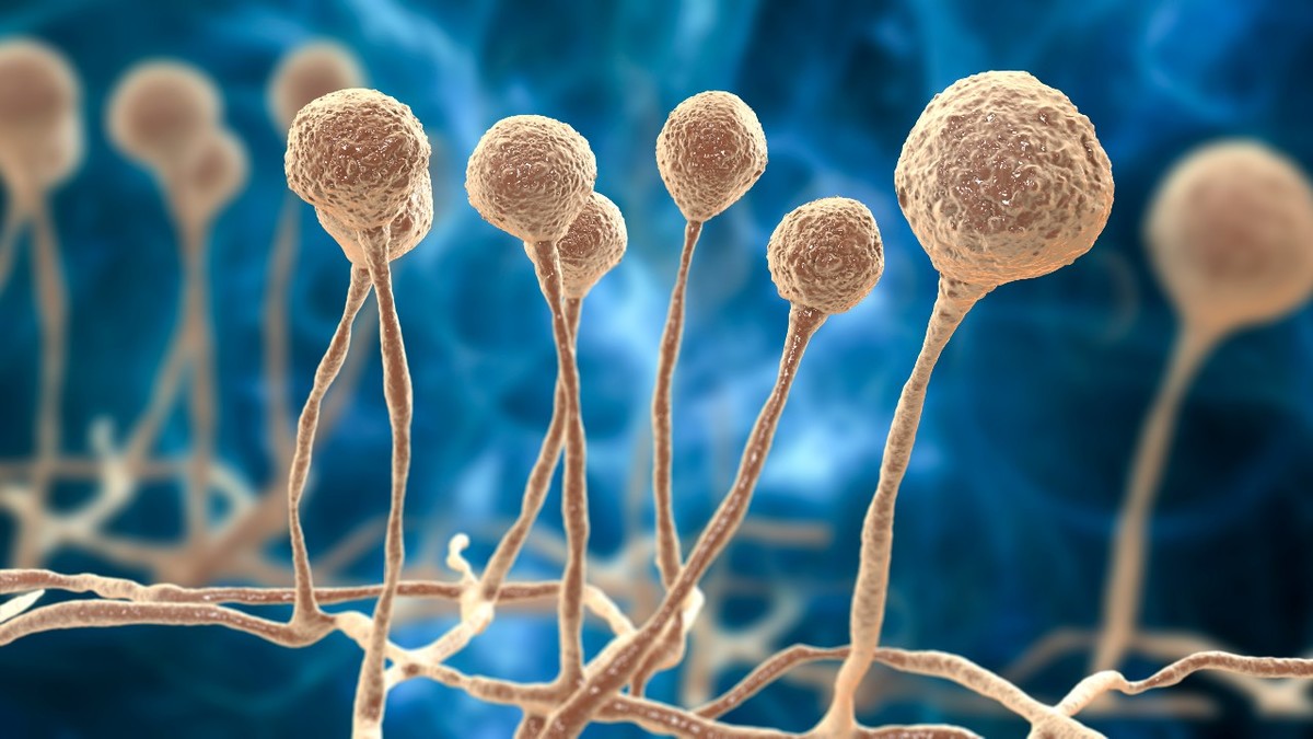 Salud de Sinaloa confirma cuatro casos de hongo negro - Grupo Milenio